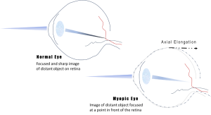 Reading and Understanding an Ocular Prescription - Stan Isaacs Ortho K ...